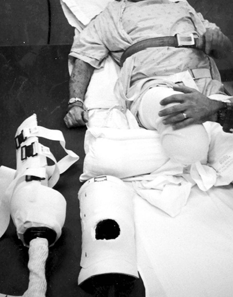 Removable Immediate Post Operative System – MOVING FORWARD