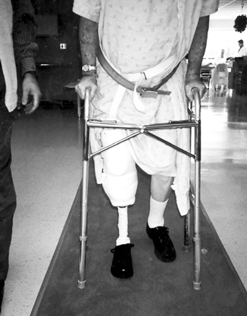 Removable Immediate Post Operative System – MOVING FORWARD